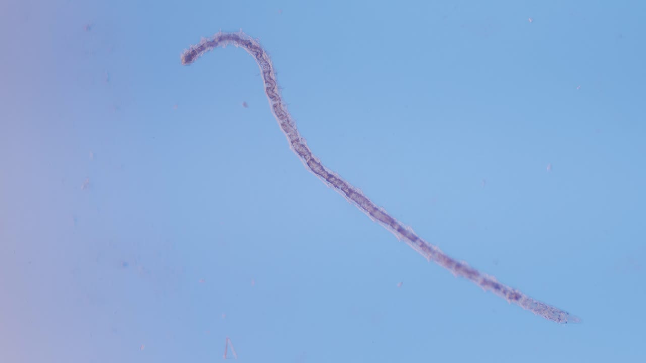 Ceratopogonidae Biting Midge Larva Stage In Water Under Microscope Free ...