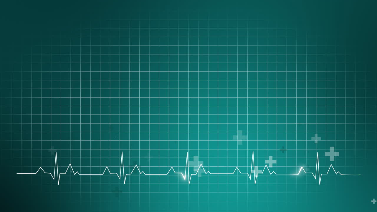 ECG graphic | freepik
