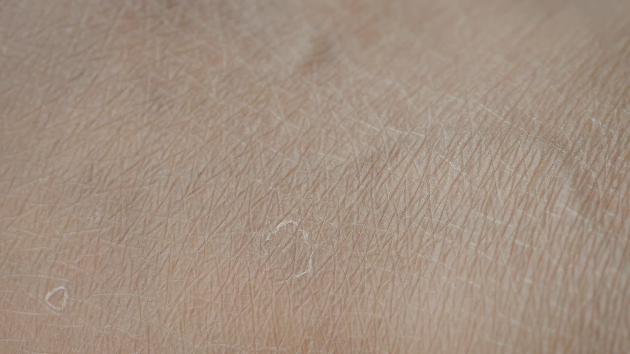 Close-up of dry skin | Premium Stock Video Footage