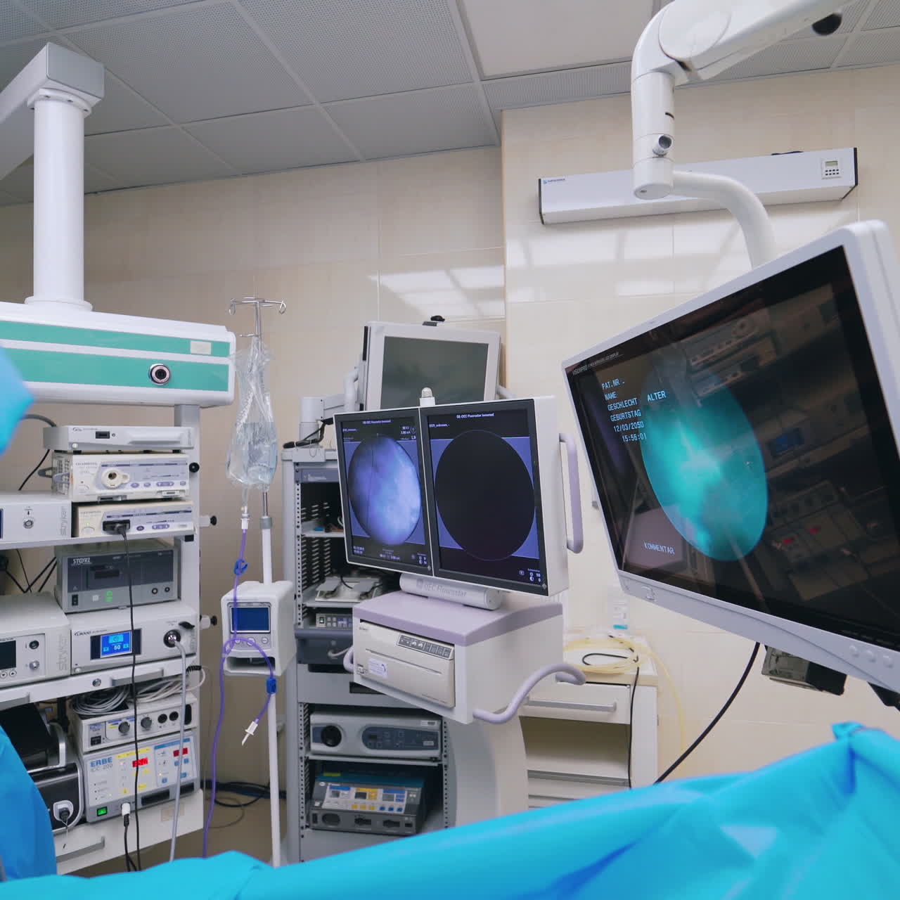 Contemporary equipment inside the operating room. Endoscopy surgery on ...