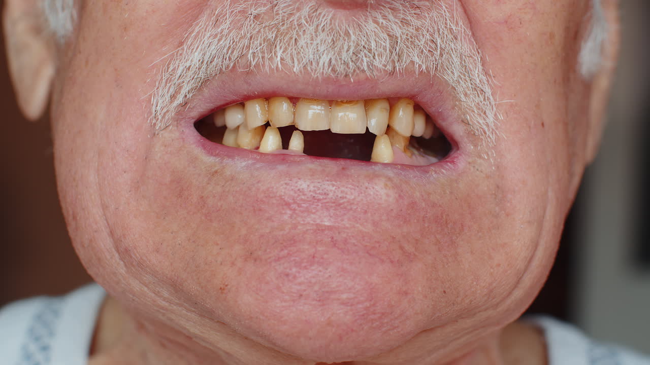 Vídeo Premium - Sonrisa masculina sin dientes boca de anciano anciano ...