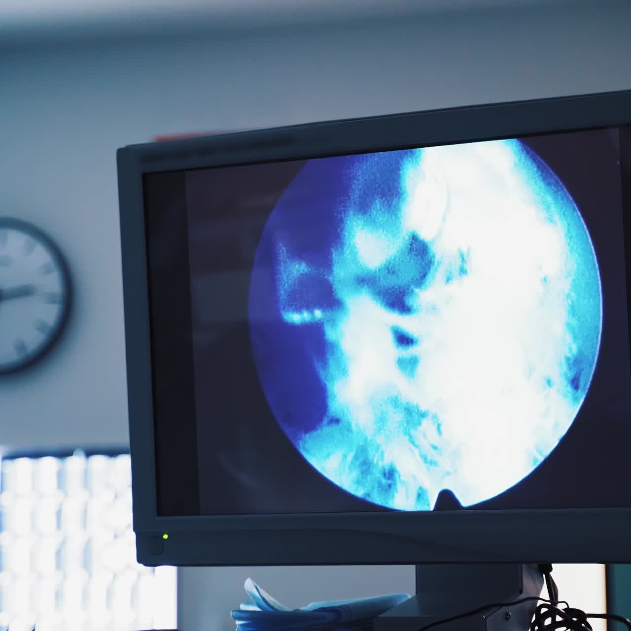 Ultrasound scanning in x ray | Premium Stock Video Footage