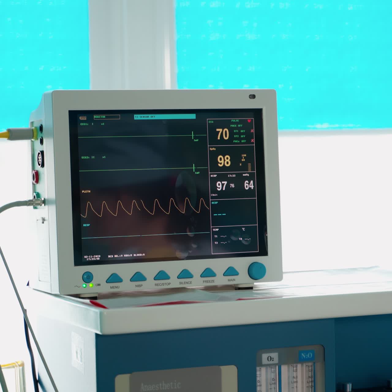 Heart rate monitor in operating room. Medical vital signs monitor. ECG ...