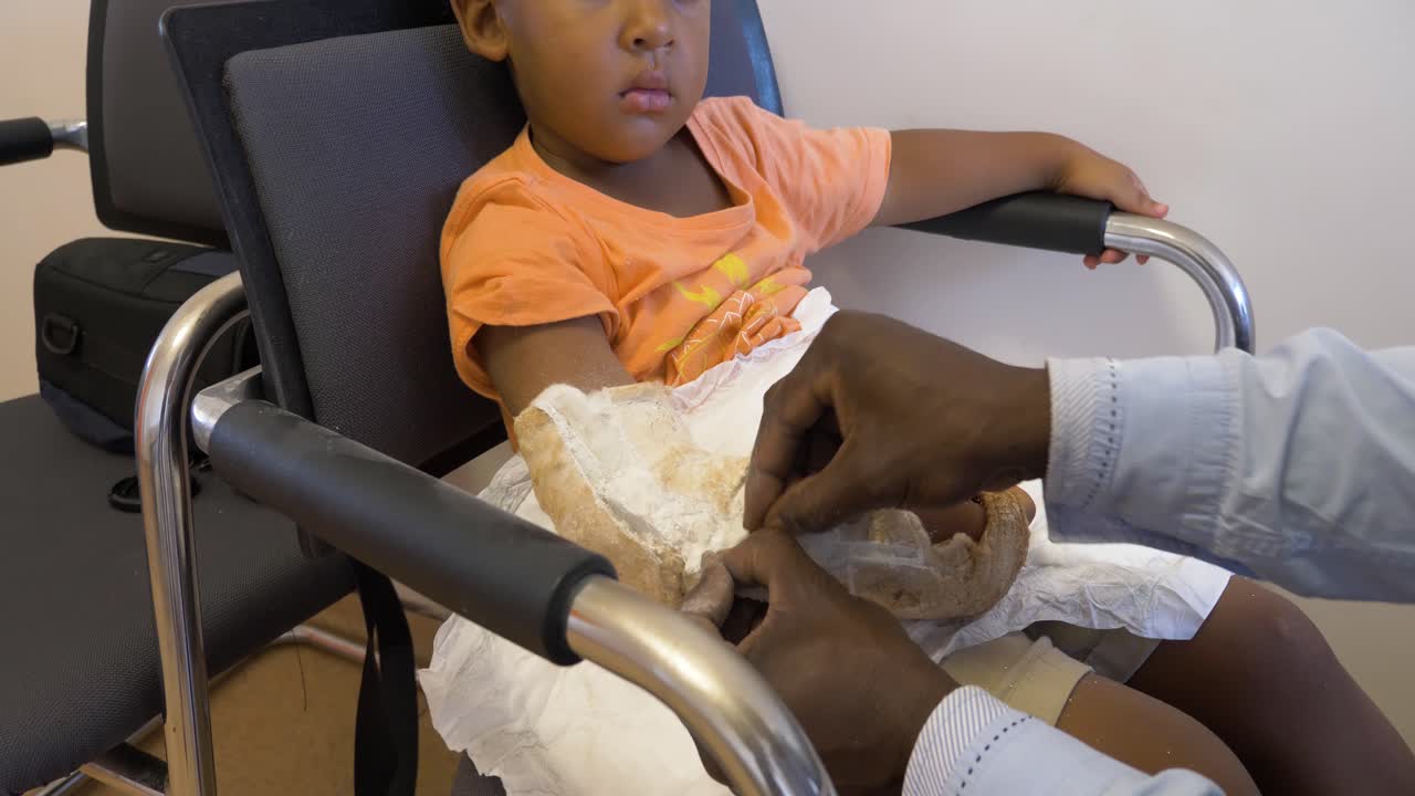 A Young Mixed Raced Child Having A Cast Removed From His Arm After A ...