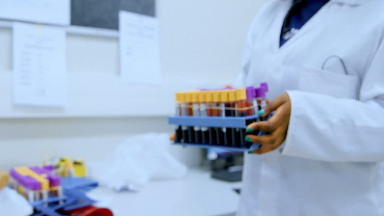 Premium stock video - Laboratory technician carry blood samples rack 4k