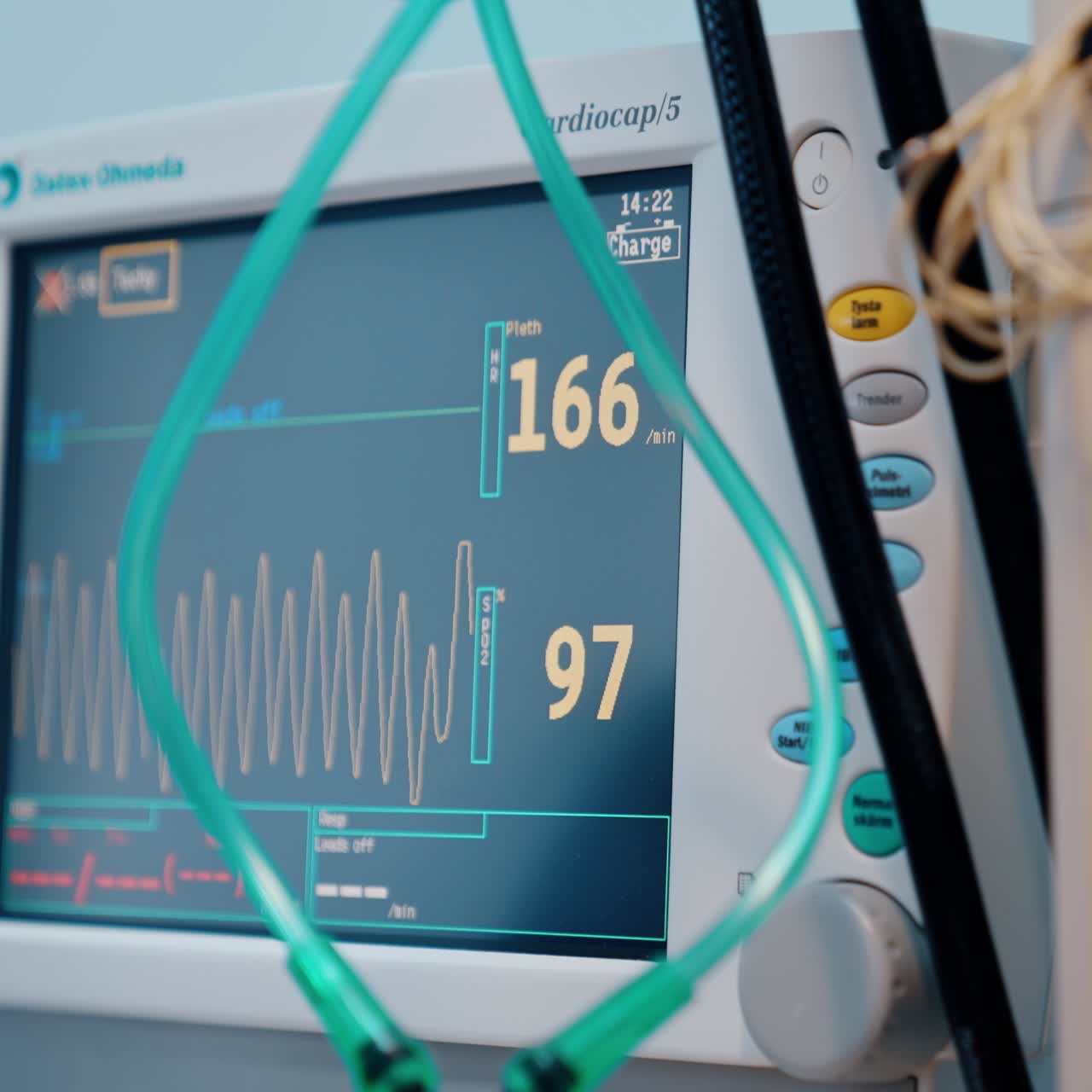 Gloved hand of a medic pressing the buttons on the screen of medical ...
