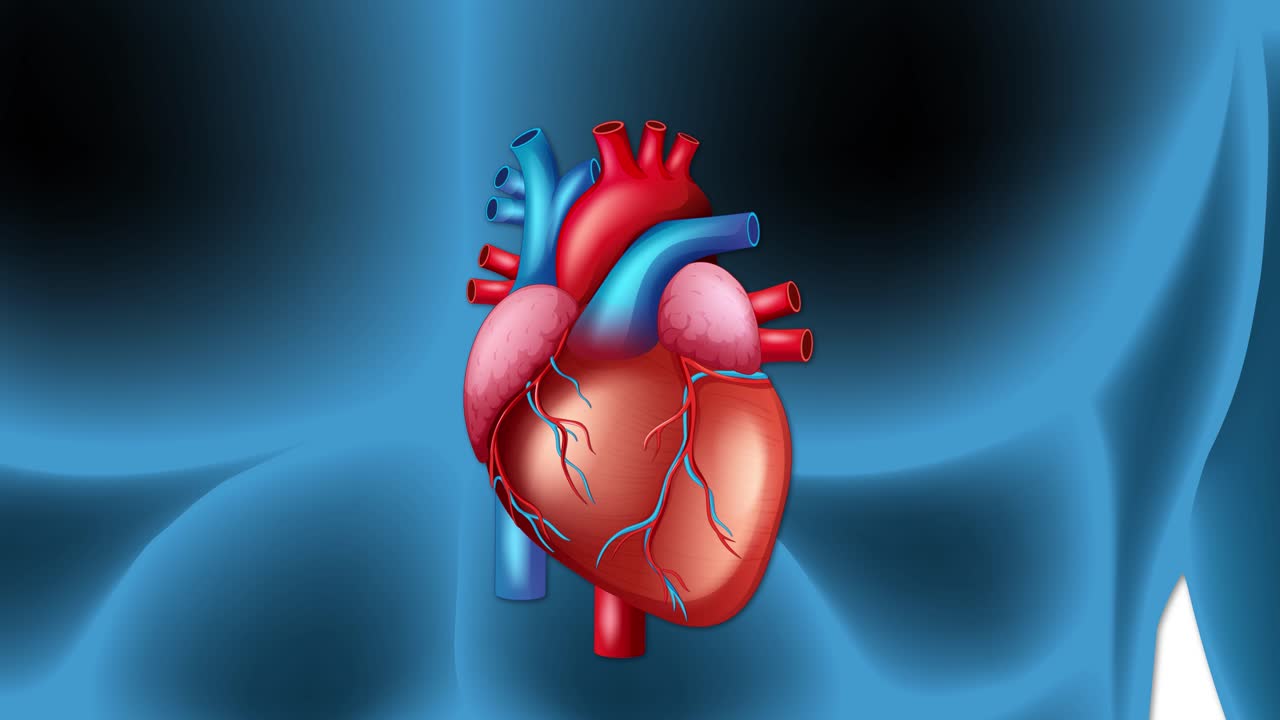 Animation illustrating coronary artery disease progression with plaque ...