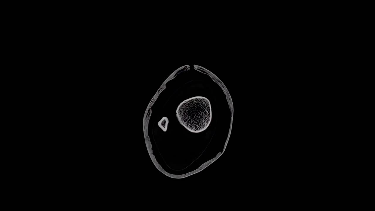 Vídeo de arquivo Premium - Ressonância magnética de um pé mostrando ... Vídeo de arquivo Premium - Ressonância magnética de um pé mostrando ...