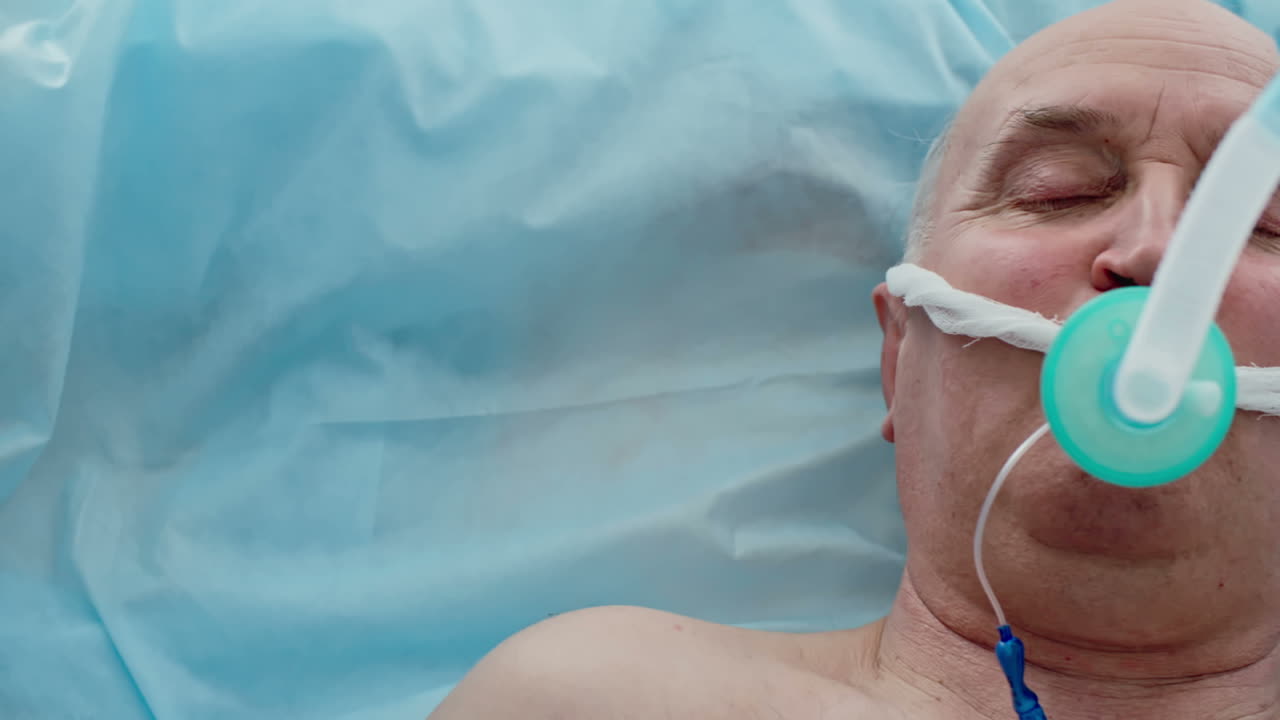 Free stock video - Top view of intubated senior man in hospital bed ...