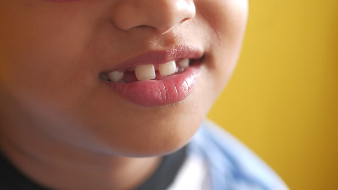 Premium stock video - Child smiling with teeth missing