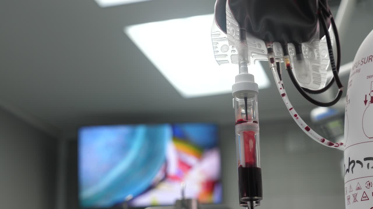 Premium stock video - Blood transfusion during a heart transplant surgery