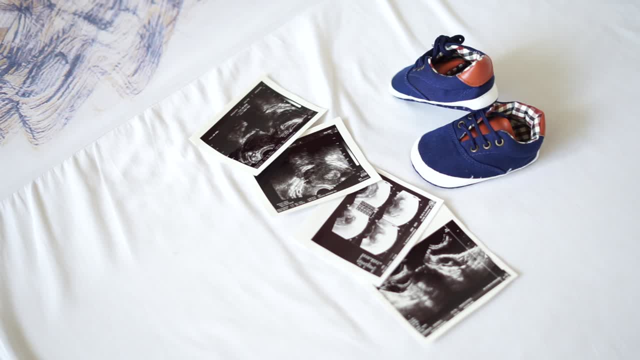 Baby shoes and ultrasound photo. Pregnancy concept | Premium Stock ...