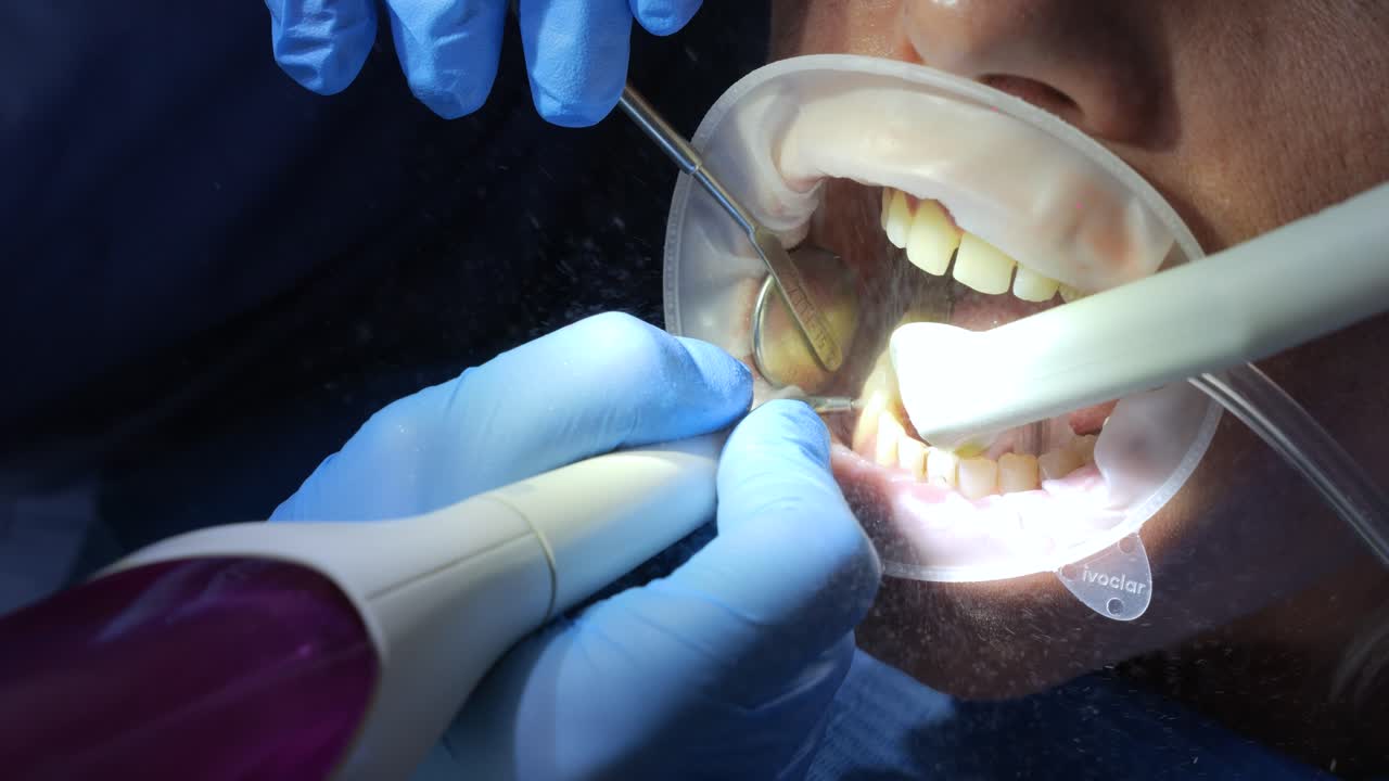 Premium stock video - Dentist uses water flosser to perform teeth ...