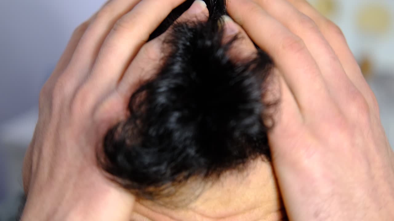 Premium Stock Video Hair Loss Sides